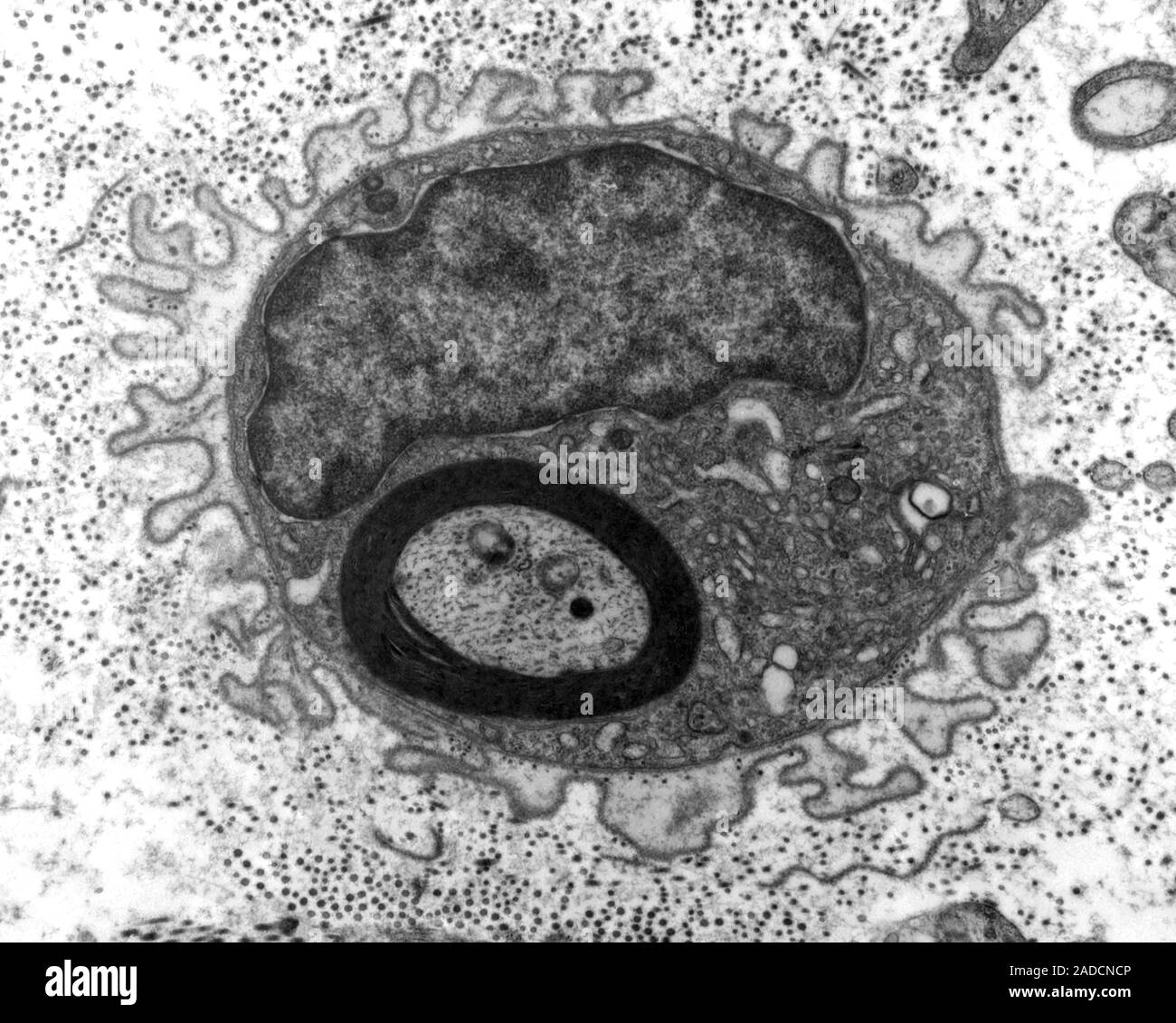 Regenerating nerve cell. Transmission electron micrograph (TEM) of a ...