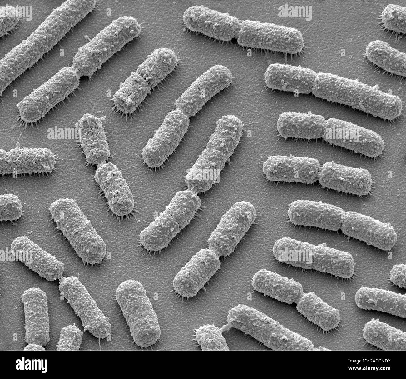 Bacillus megaterium bacterial colony, scanning electron micrograph (SEM ... Bacillus megaterium bacterial colony, scanning electron micrograph (SEM ...
