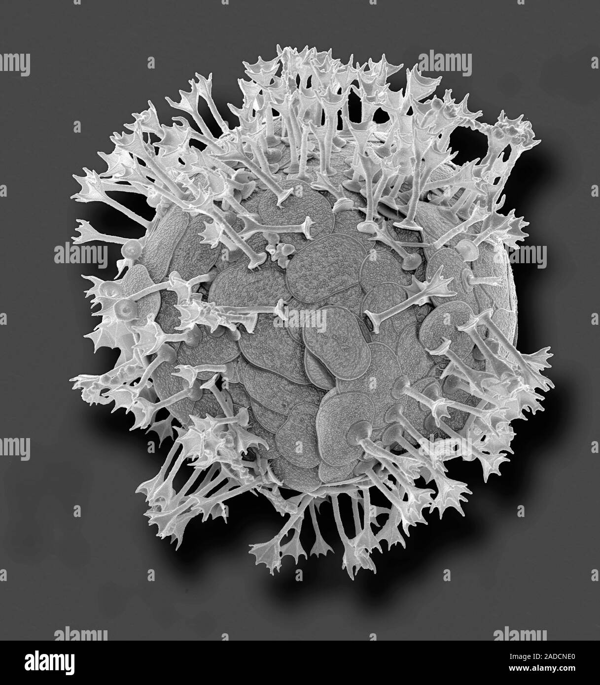 Acanthocystis. Scanning electron micrograph (SEM) of a centrohelid ...