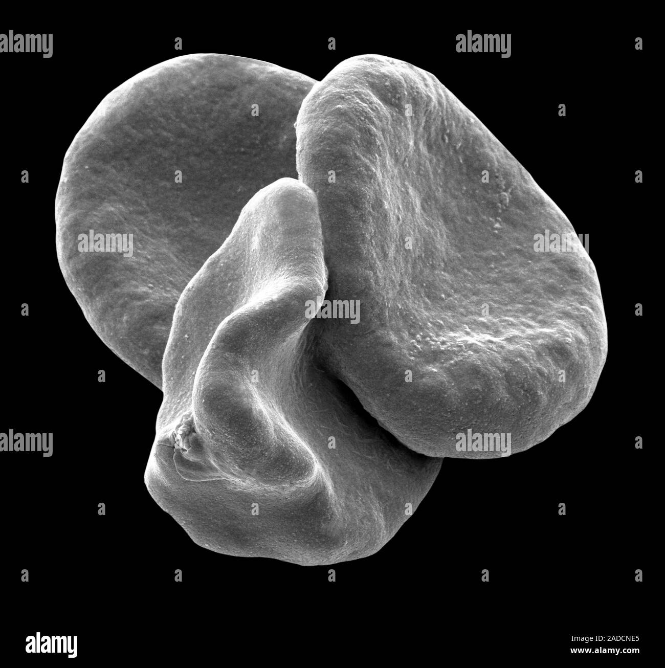 Red blood cells. Scanning electron micrograph (SEM) of red blood cells ...