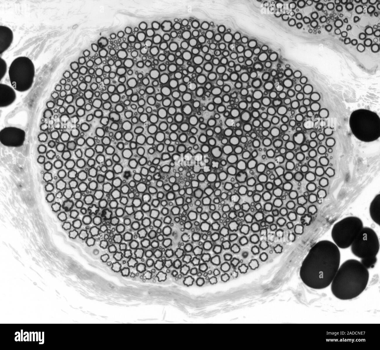 Nerve fibres. Light micrograph (LM) of a transverse section through a ...