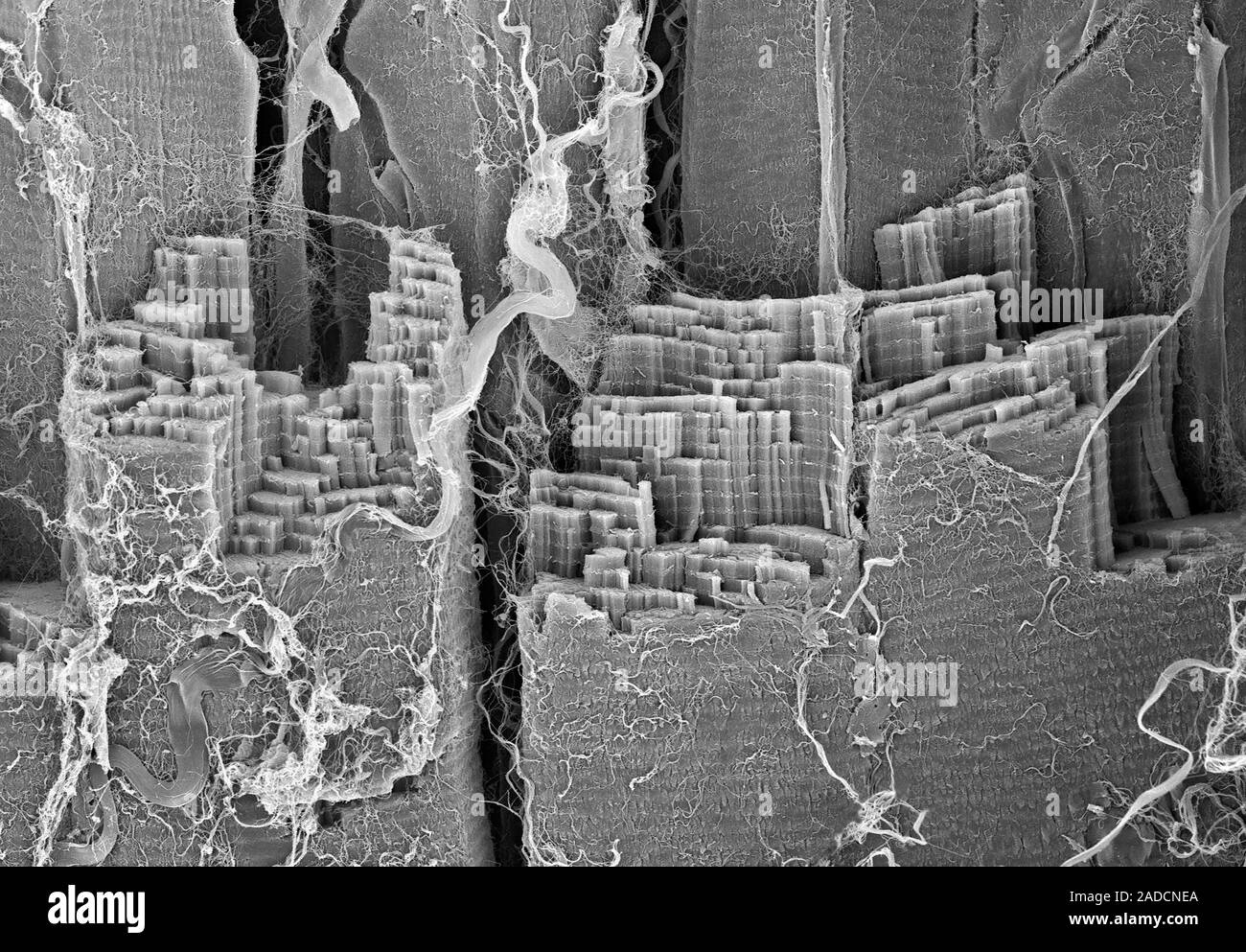 Skeletal muscle fibre. Scanning electron micrograph (SEM) of a freeze-fractured skeletal (or ...