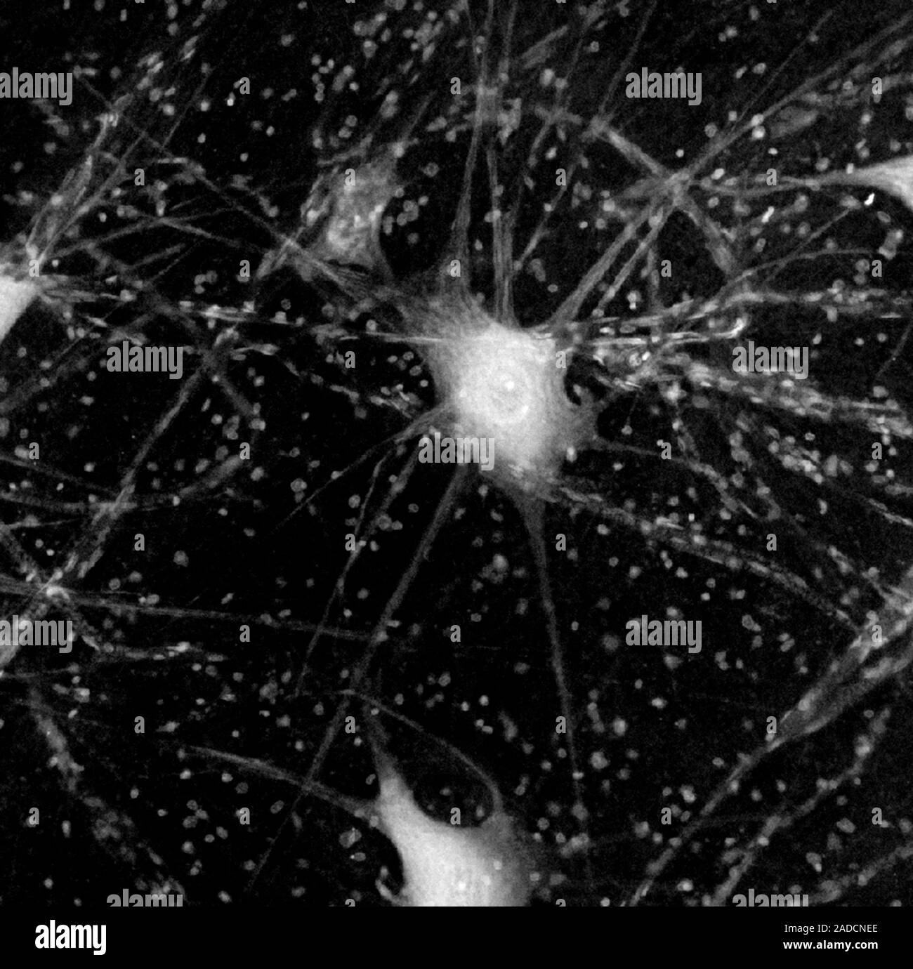 Motor neurons, light micrograph (LM). Motor neurons are responsible for ...