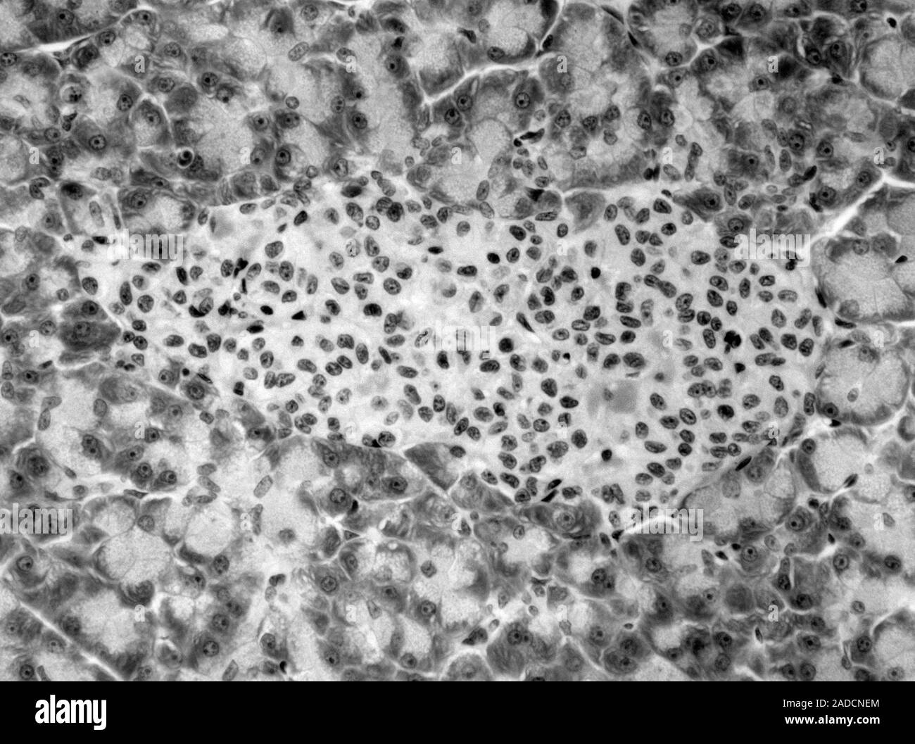 Islet of Langerhans. Light micrograph of a section through an islet of ...
