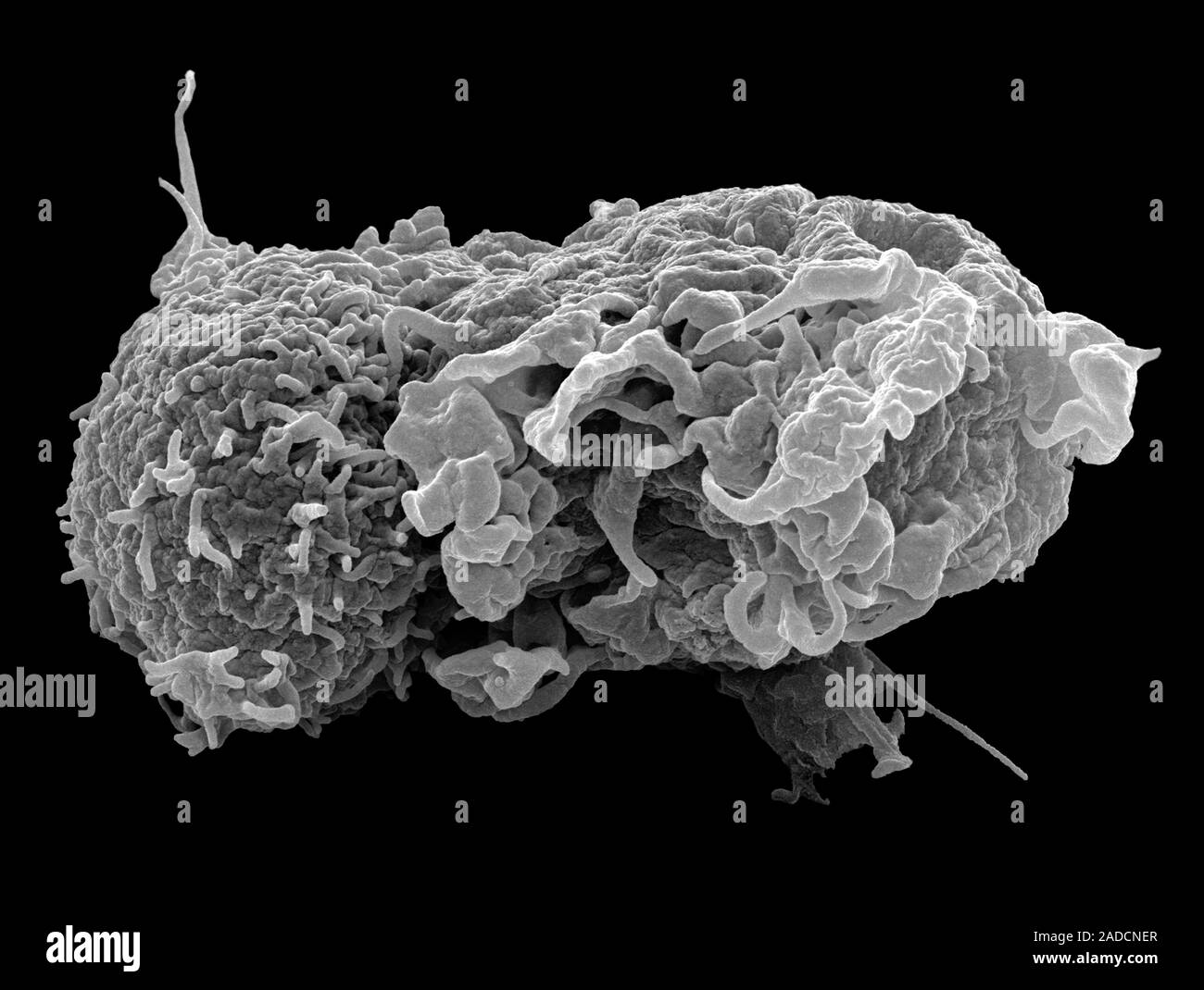 Antigen presentation. Scanning electron micrograph (SEM) showing the ...