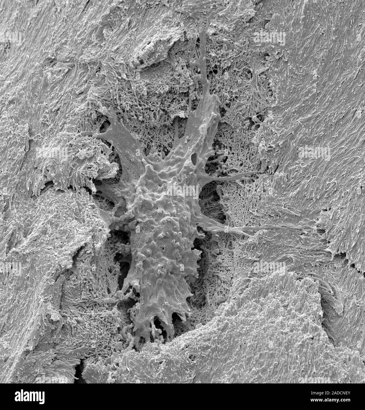 Osteocyte bone cell. Scanning electron micrograph (SEM) of an osteocyte ...