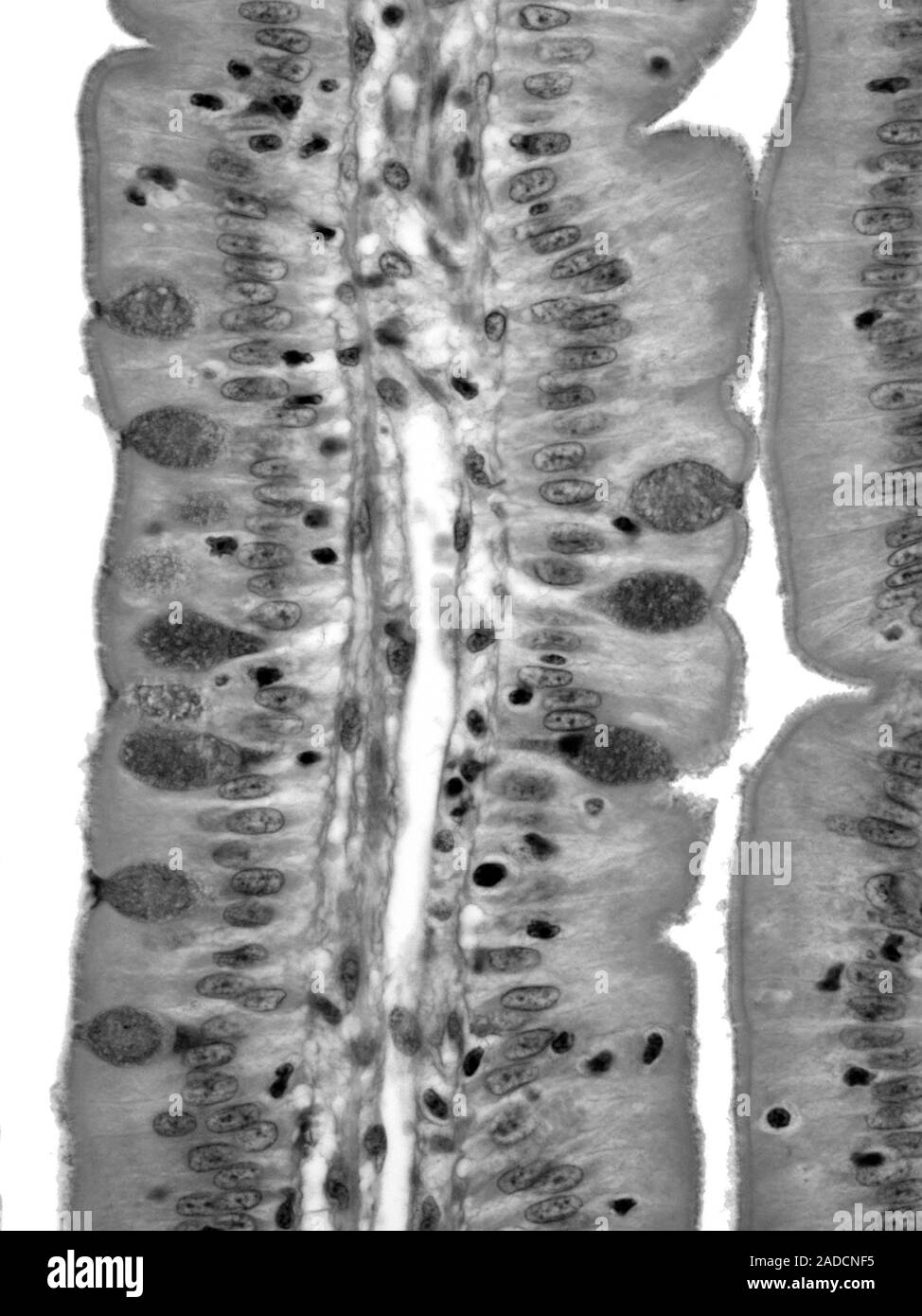 Small intestine. Light micrograph (LM) of a section through the finger ...