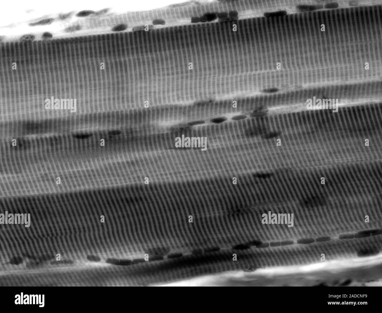 Skeletal muscle fibres. Light micrograph (LM) of a section through a ...
