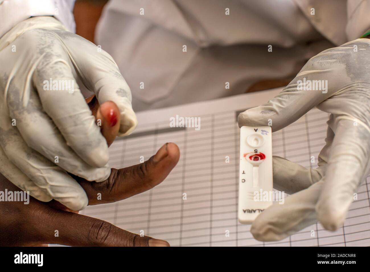 Malaria rapid diagnostic test. Close-up of a malaria testing device ...