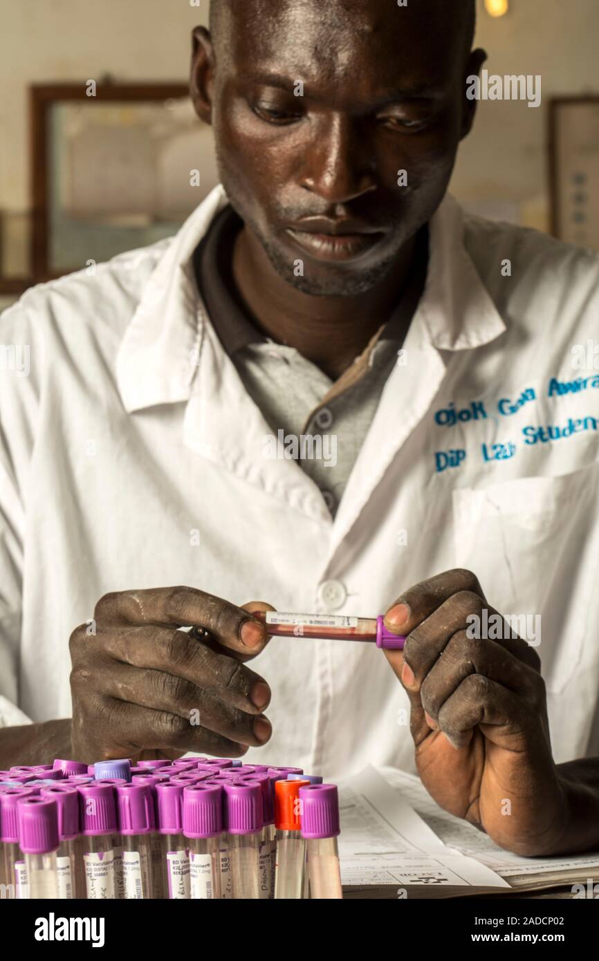 Blood sample analysis. Medical student handling a blood sample in a ...