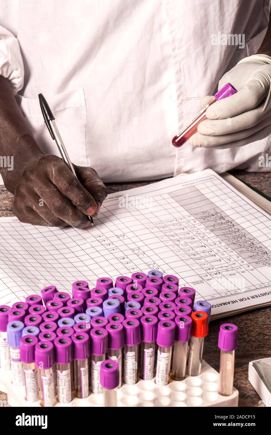 Blood sample analysis. Medical student working with blood samples in a ...
