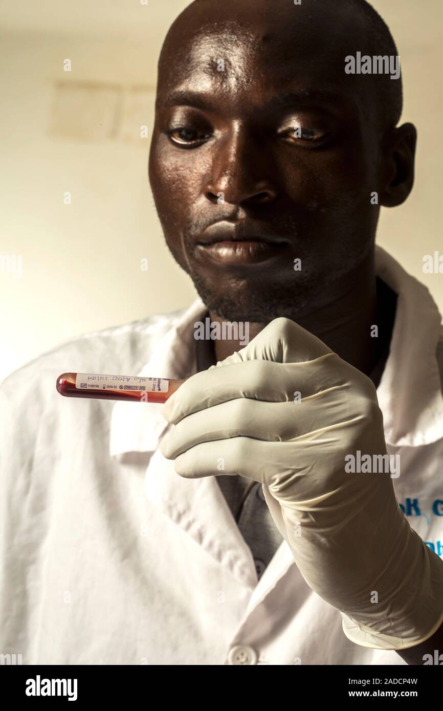 Blood sample analysis. Medical student handling a blood sample in a ...