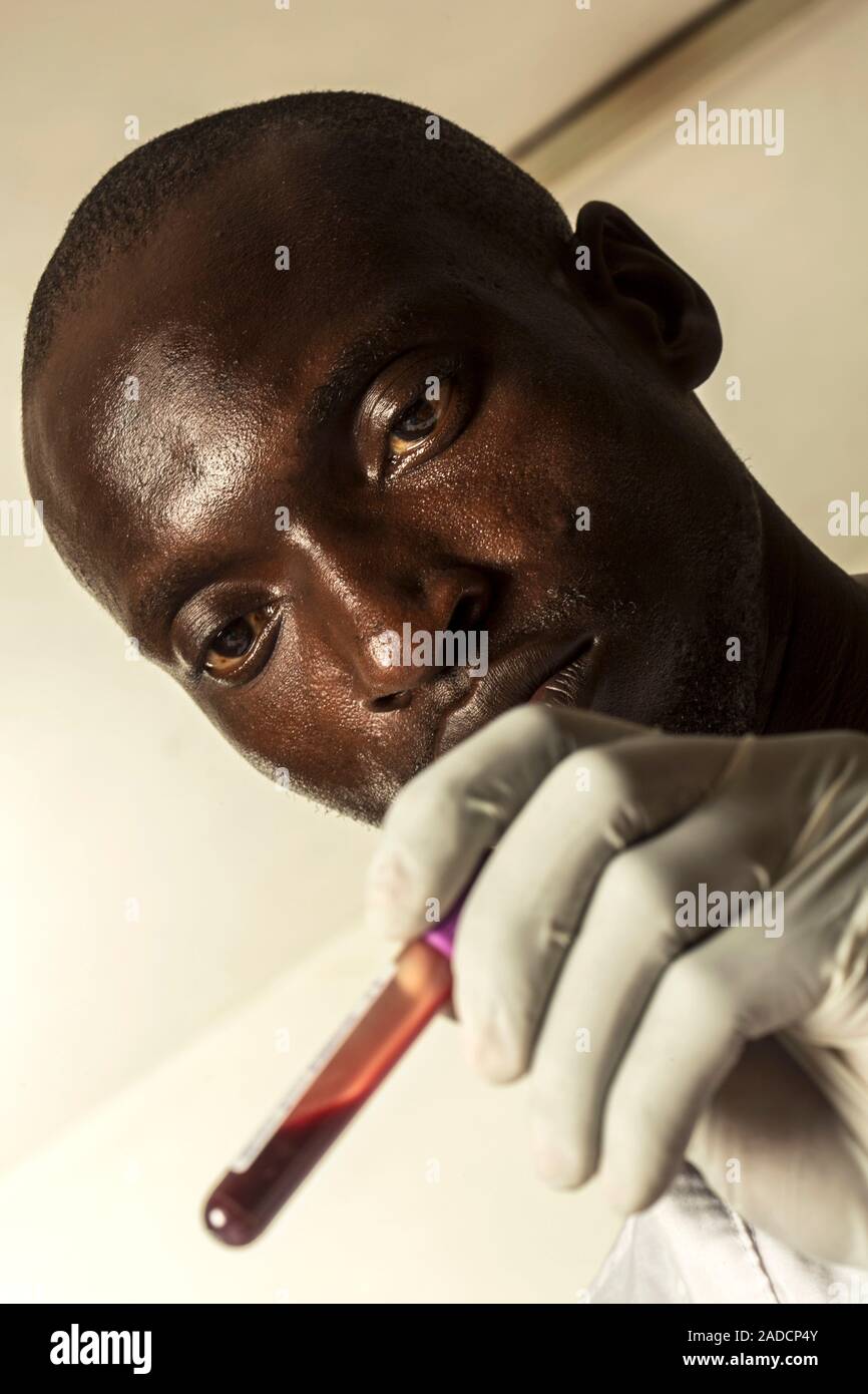Blood sample analysis. Medical student handling a blood sample in a ...