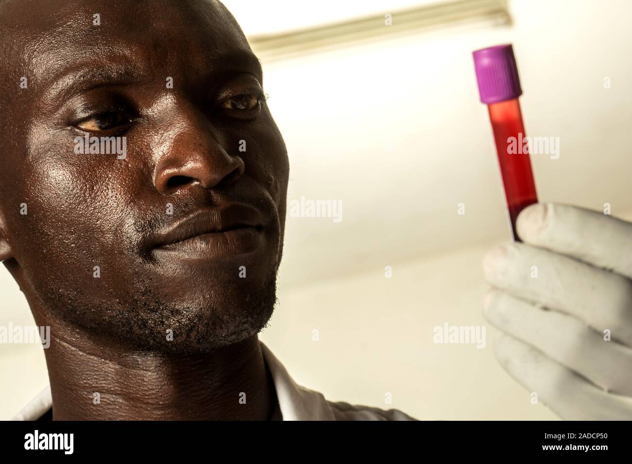 Blood sample analysis. Medical student handling a blood sample in a ...