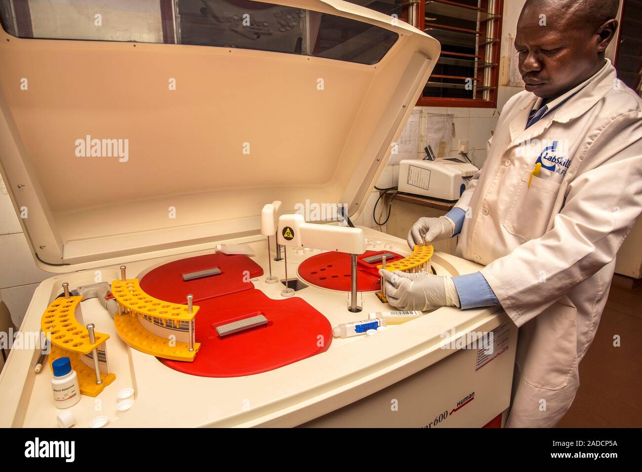Automated medical analysis. Laboratory technician using an automated ...
