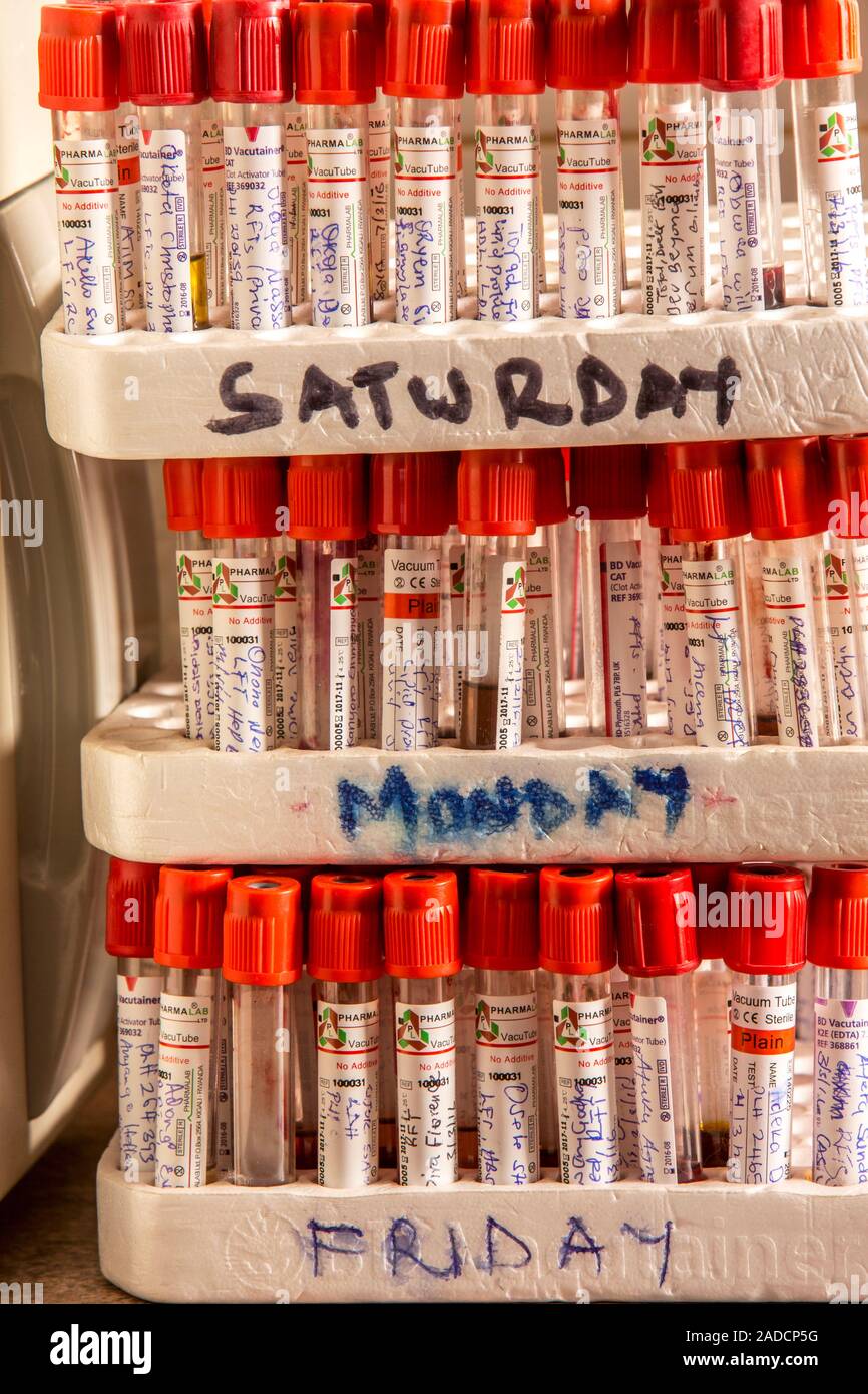 Blood samples. Vacutainers containing blood samples awaiting analysis ...