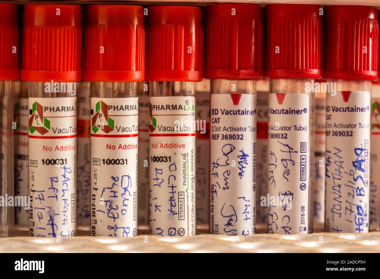 Blood samples. Vacutainers containing blood samples awaiting analysis ...