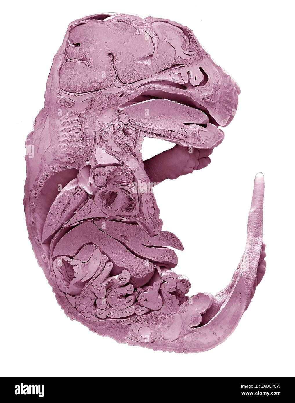 Mouse embryo. Scanning electron micrograph (SEM) of a sagittal ...