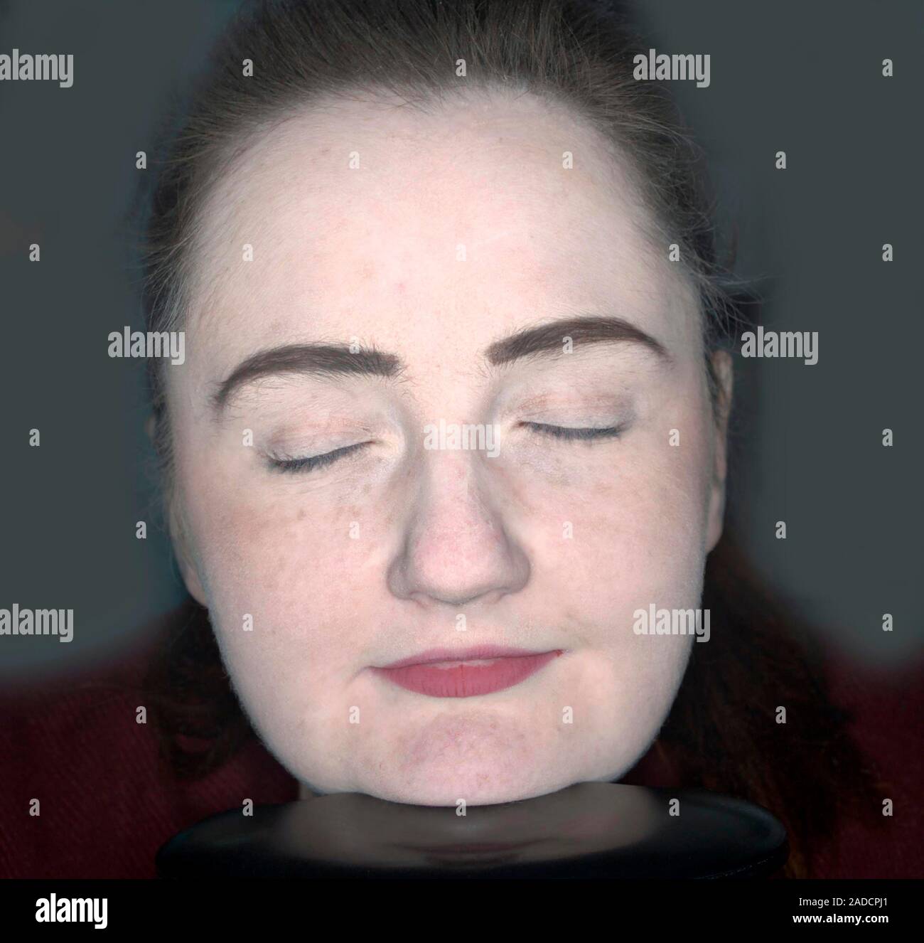 Skin health analysis system. Colour (normal) view of a woman's face and ...