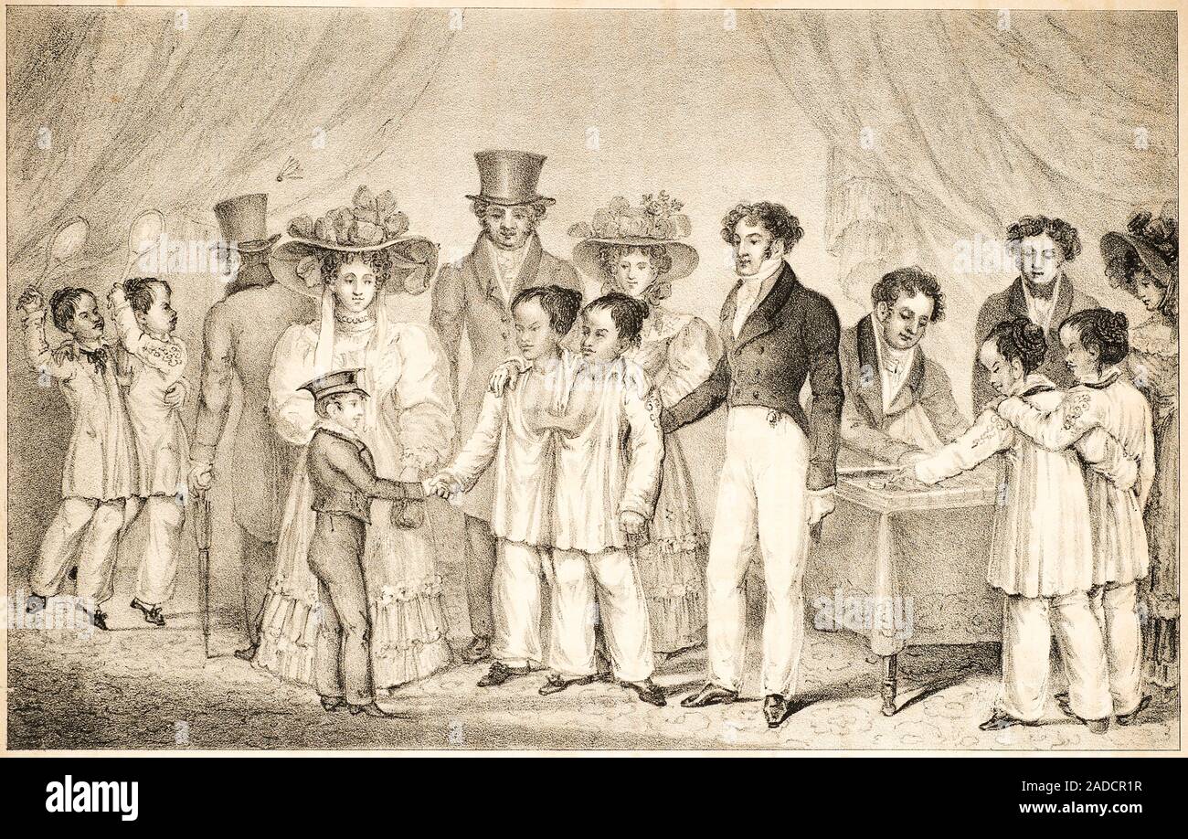 Chang and Eng (1811-1874) were conjoined twin brothers born in Siam ...