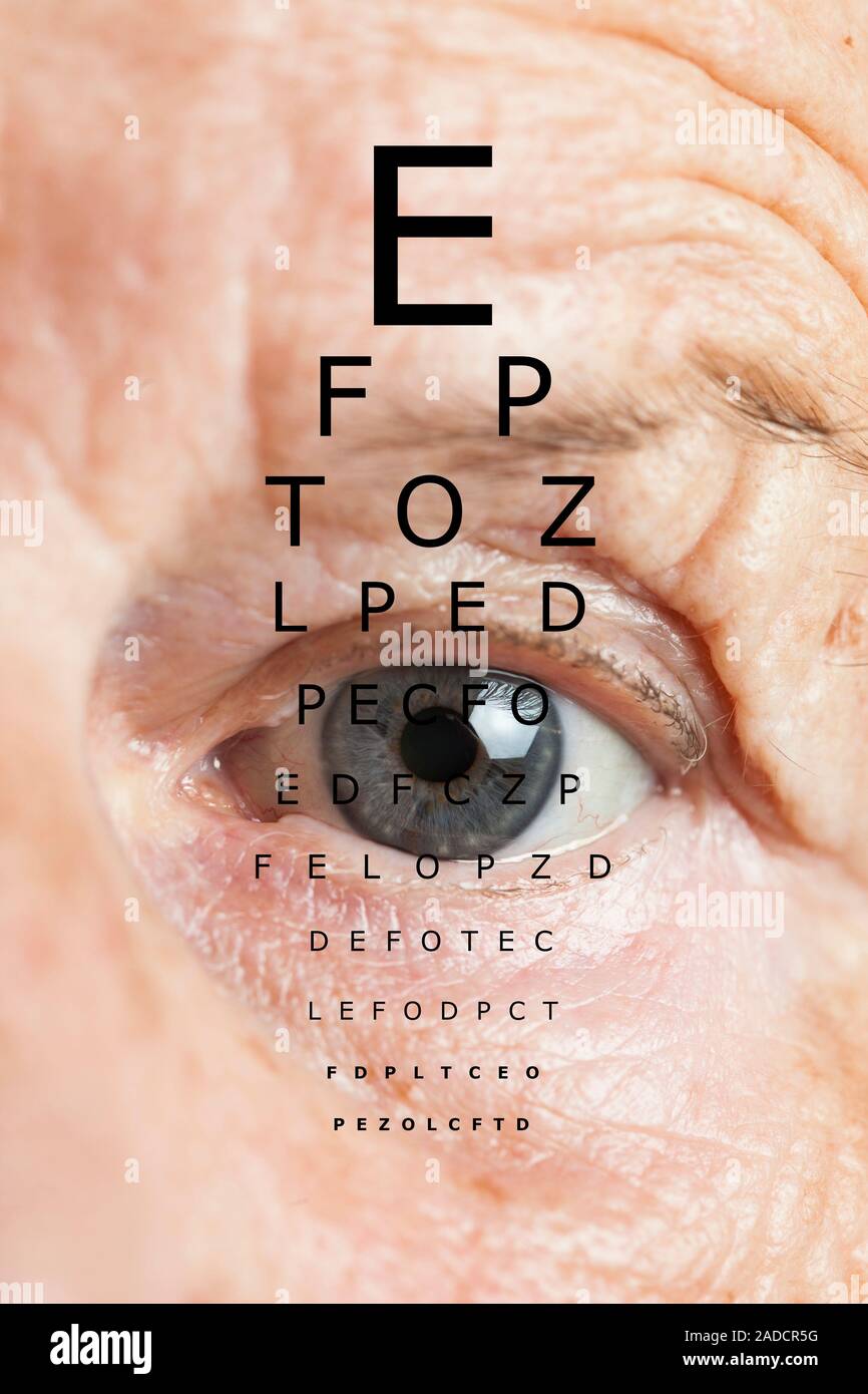 Eye test for the elderly, conceptual image. Close-up of one of the eyes ...