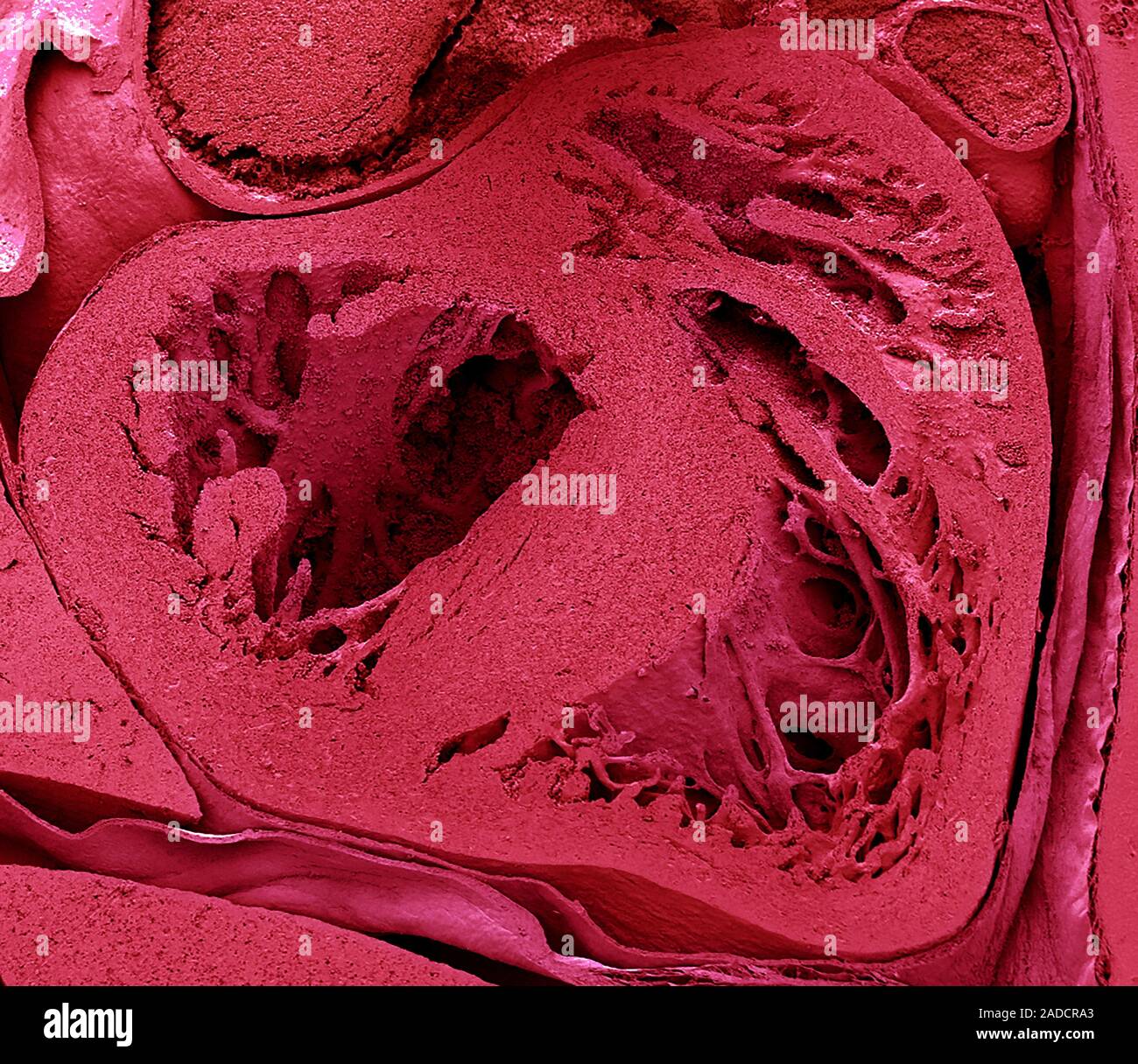 Mouse embryo heart. Coloured scanning electron micrograph (SEM) of a ...
