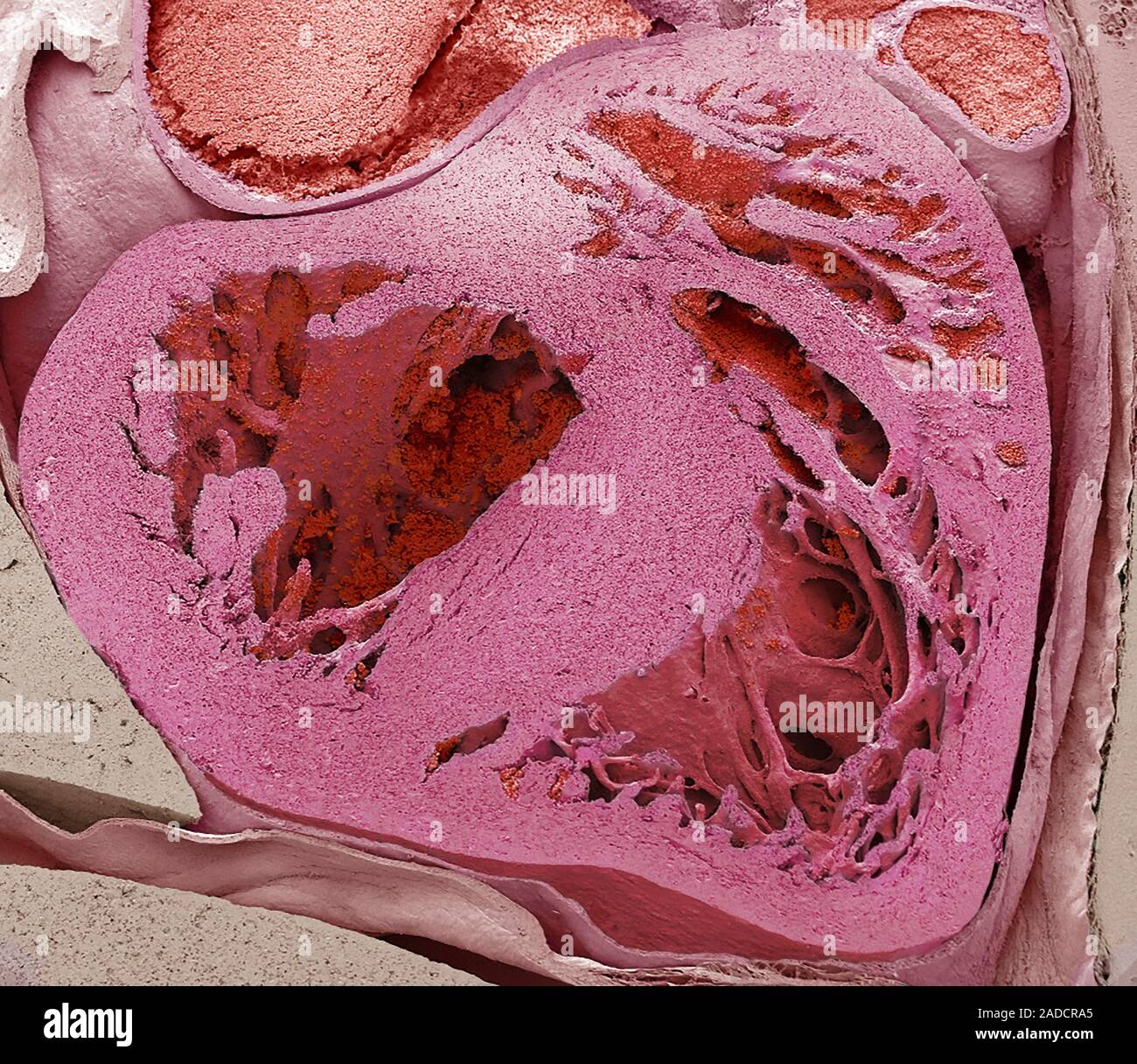 Mouse embryo heart. Coloured scanning electron micrograph (SEM) of a ...