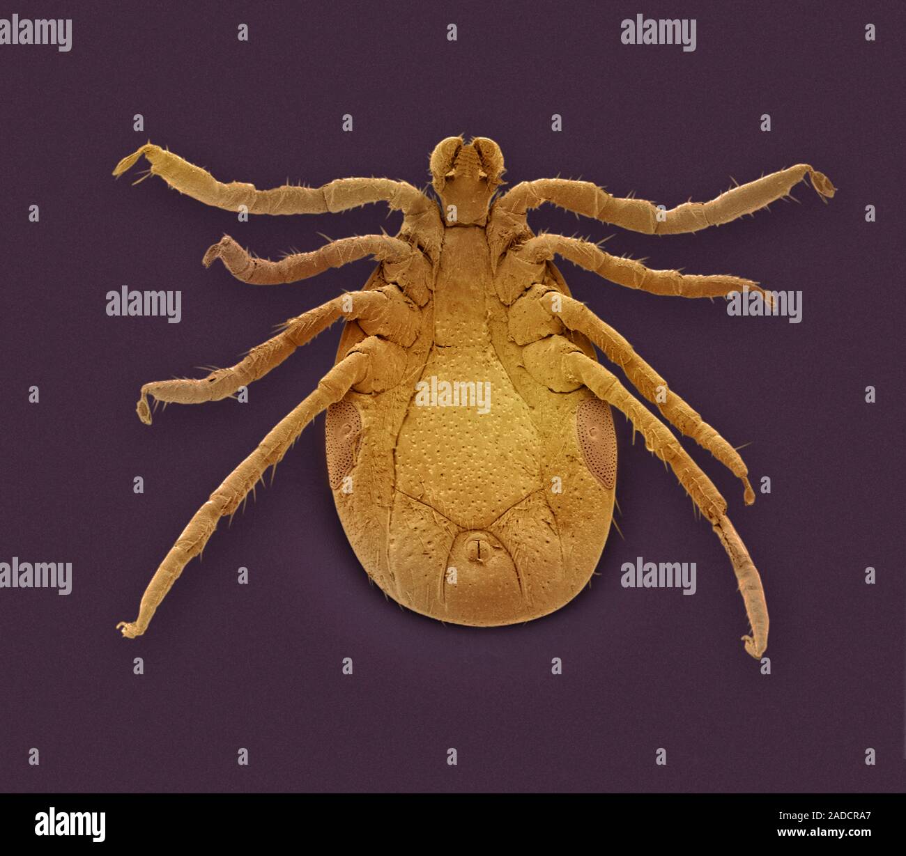 Lyme disease tick (Ixodes ricinus). Coloured scanning electron ...