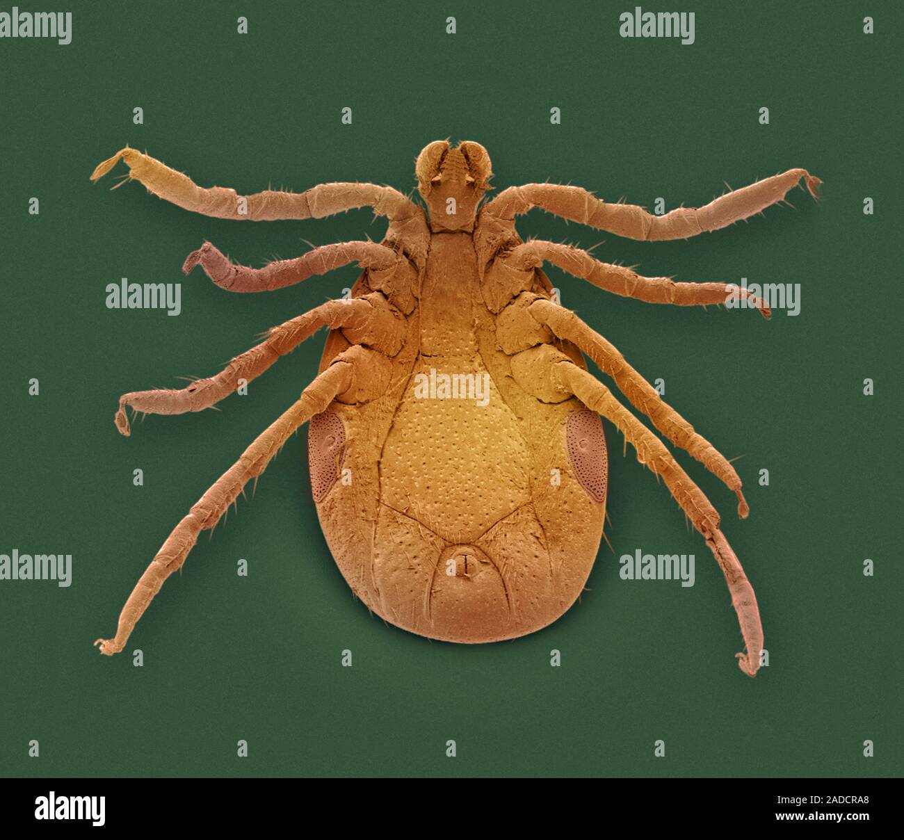 Lyme disease tick (Ixodes ricinus). Coloured scanning electron ...