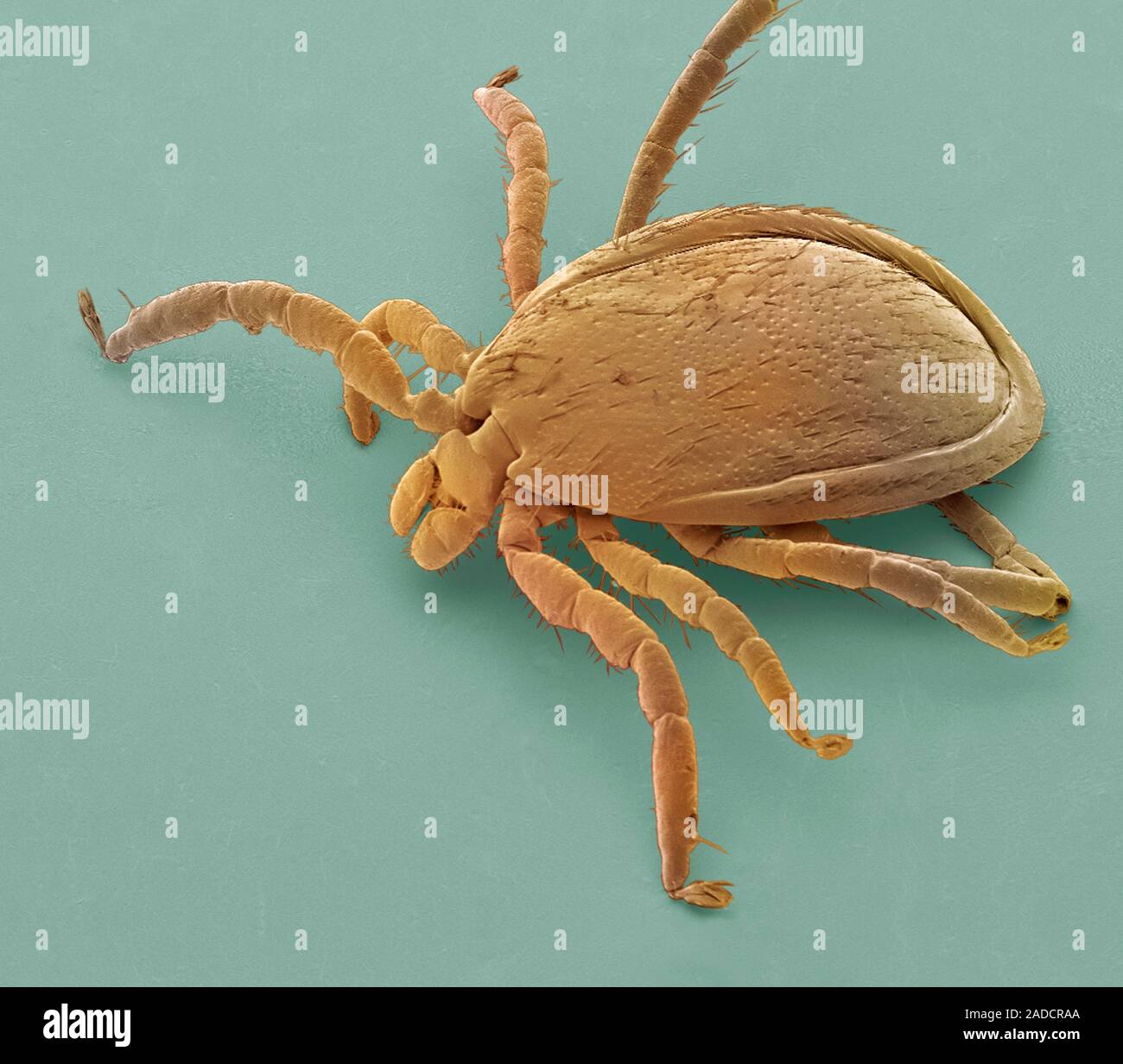 American dog tick (Dermacentor variabilis), coloured scanning electron ...