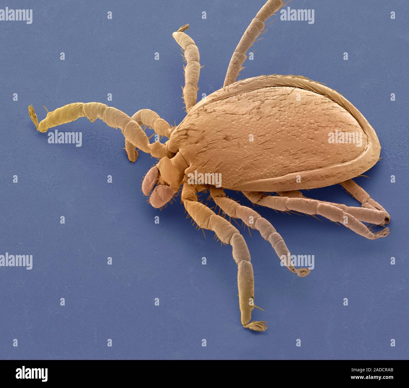 American dog tick (Dermacentor variabilis), coloured scanning electron ...