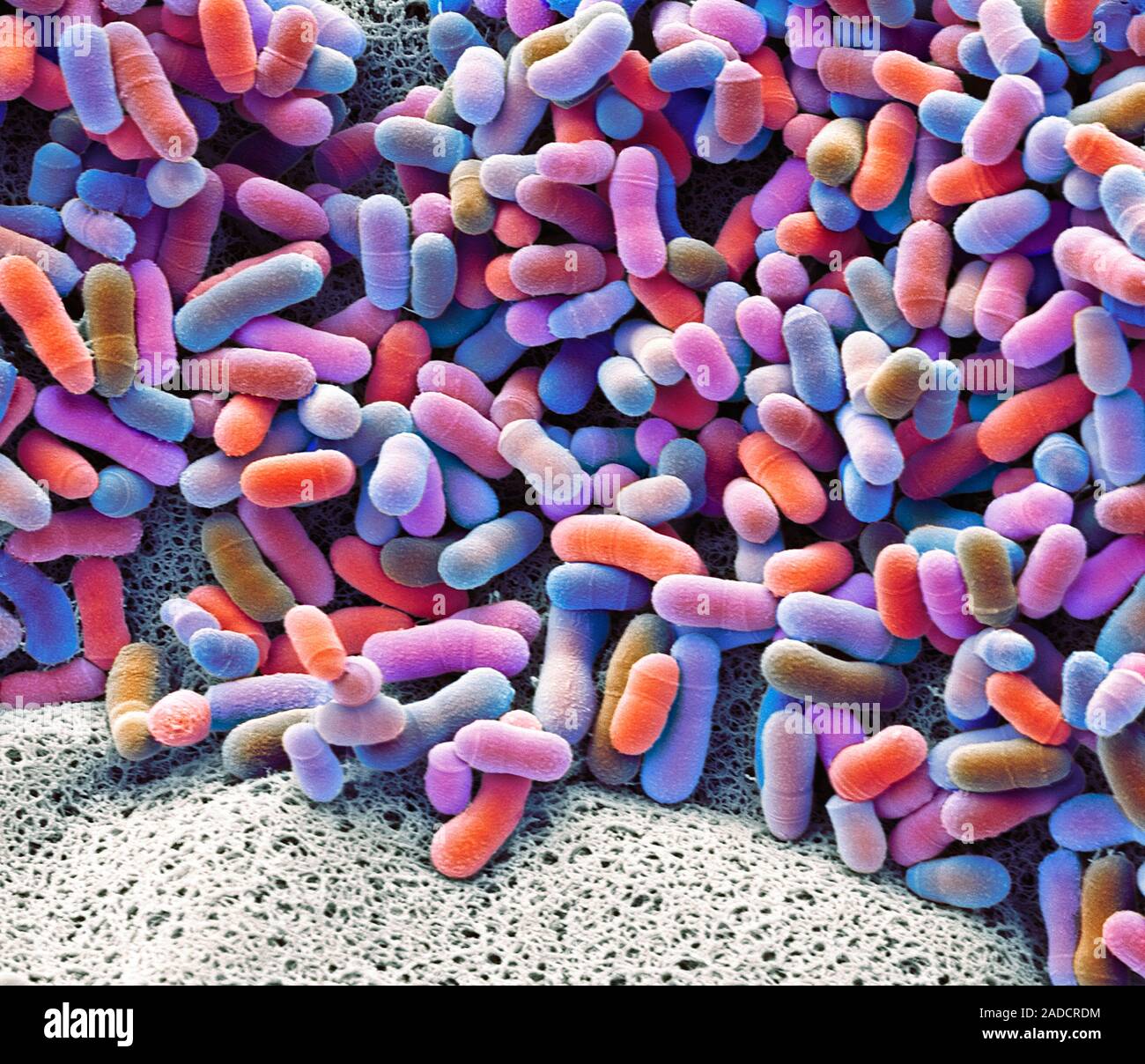 Bacteria from a human armpit. Coloured scanning electron micrograph ...