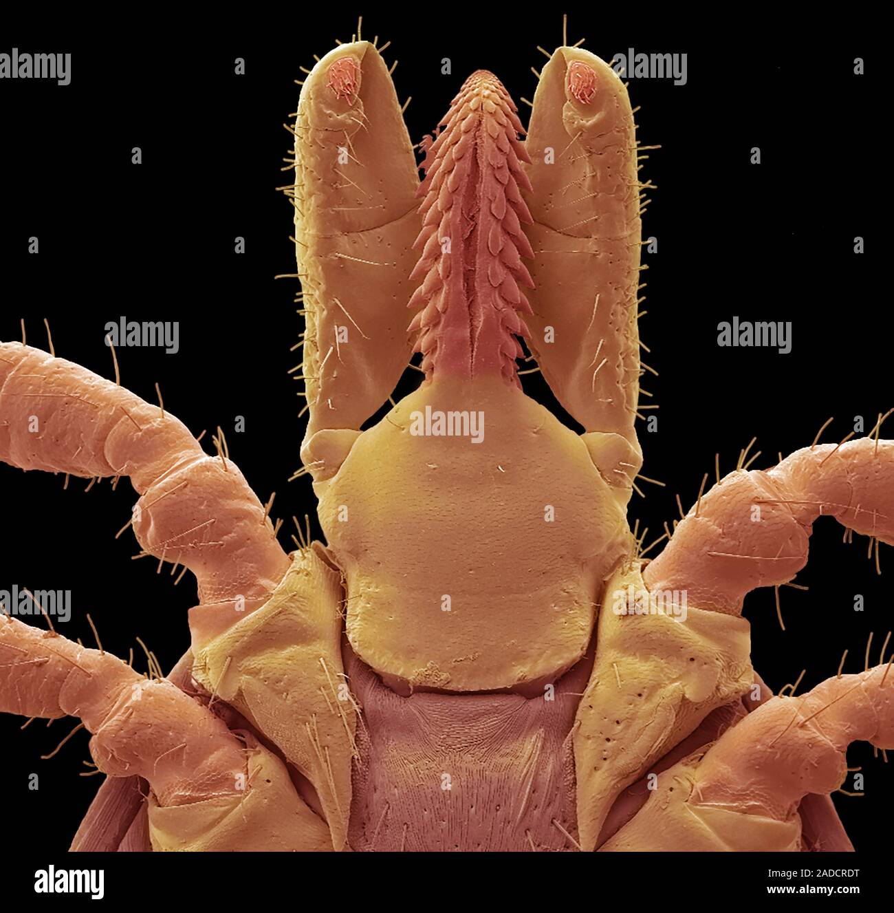 Lyme disease tick (Ixodes ricinus). Scanning electron micrograph of an ...