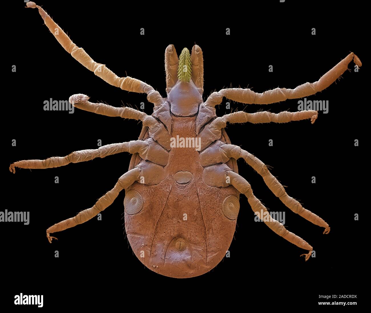 Lyme disease tick (Ixodes ricinus). Scanning electron micrograph(SEM ...