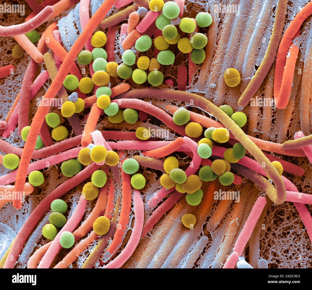 Faecal bacteria. Scanning electron micrograph (SEM) of bacteria ...