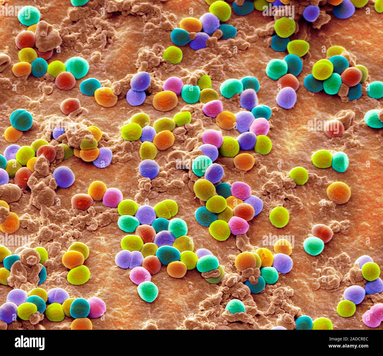 Staphylococcus bacteria, coloured scanning electron micrograph (SEM ...