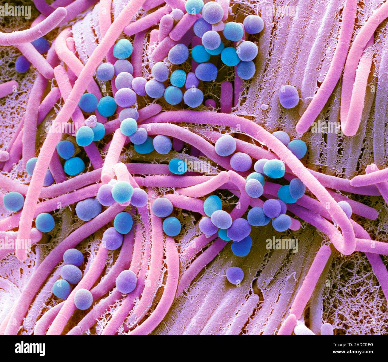 Faecal Bacteria Scanning Electron Micrograph Sem Of Bacteria Cultured From A Sample Of Human