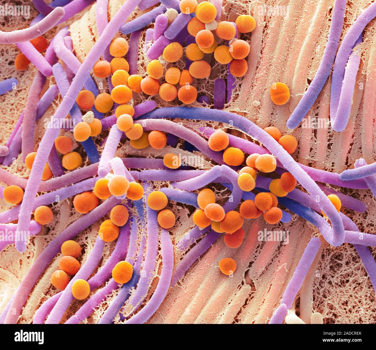 Faecal bacteria. Scanning electron micrograph (SEM) of bacteria ...