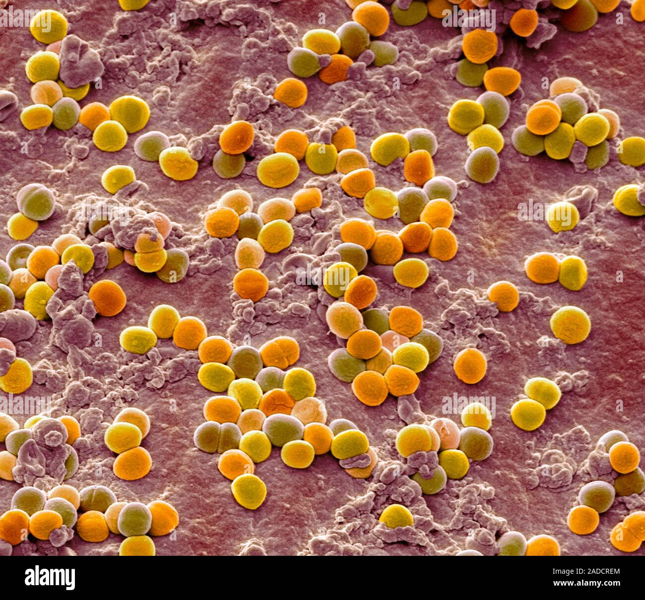 Staphylococcus bacteria, coloured scanning electron micrograph (SEM ...