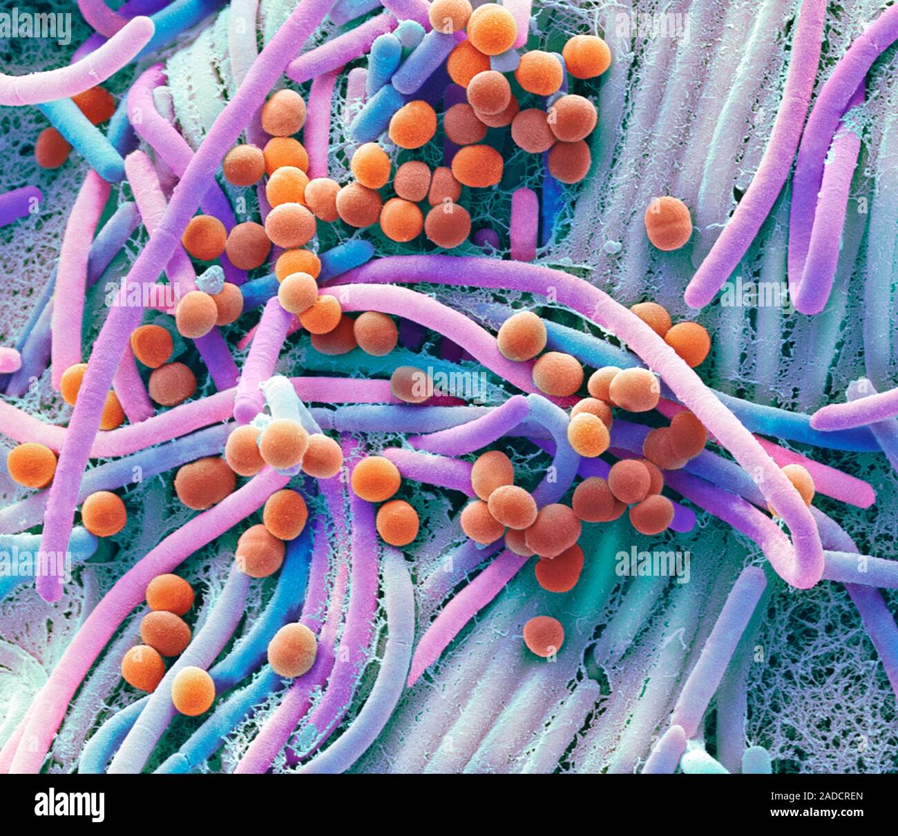 Faecal bacteria. Scanning electron micrograph (SEM) of bacteria ...