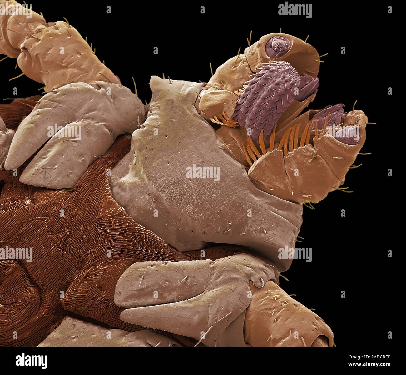 American dog tick mouth parts (Dermacentor variabilis). Scanning ...
