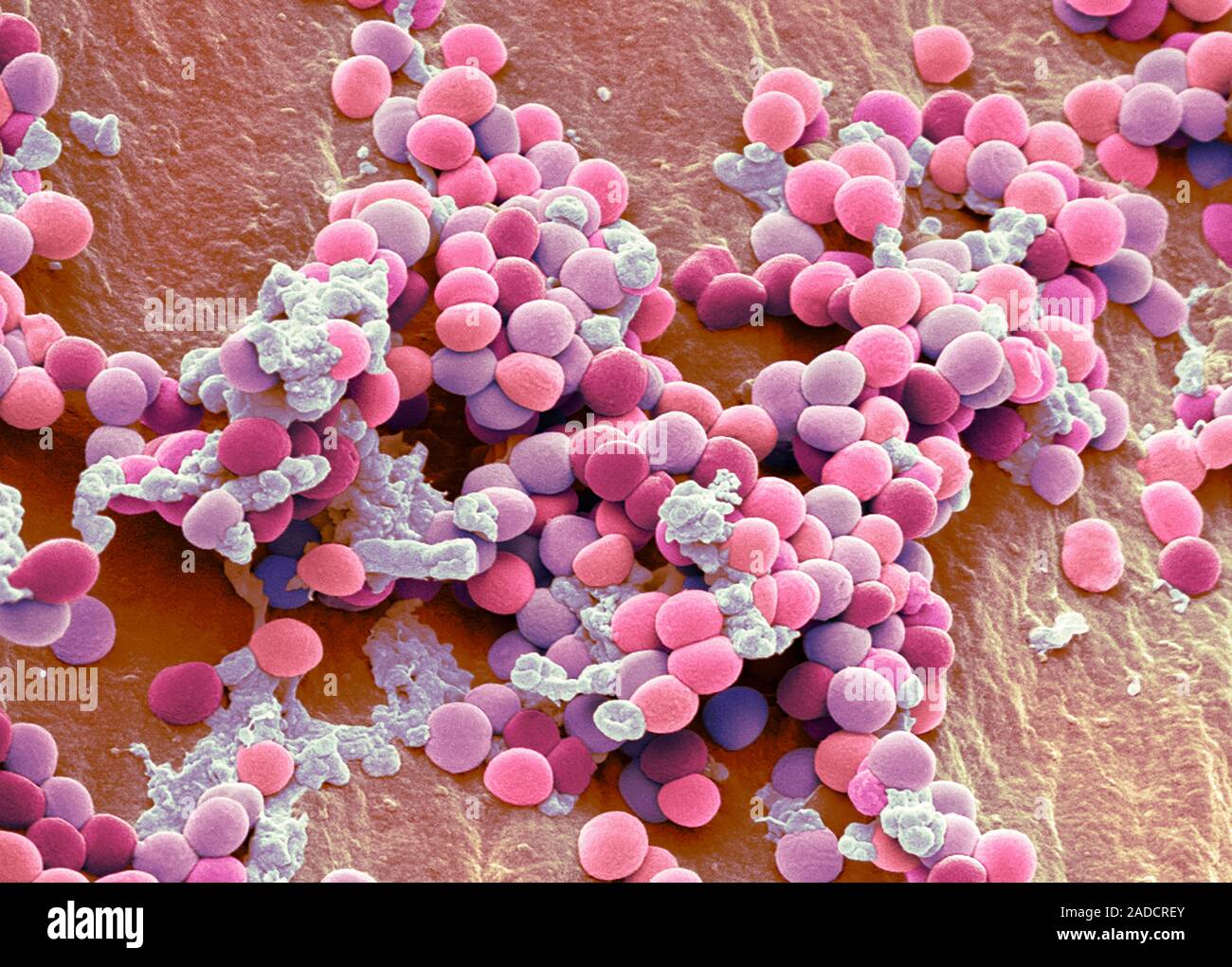 Staphylococcus bacteria, coloured scanning electron micrograph (SEM ...