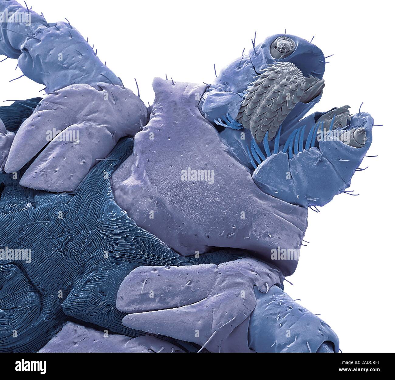 American dog tick mouth parts (Dermacentor variabilis). Scanning ...