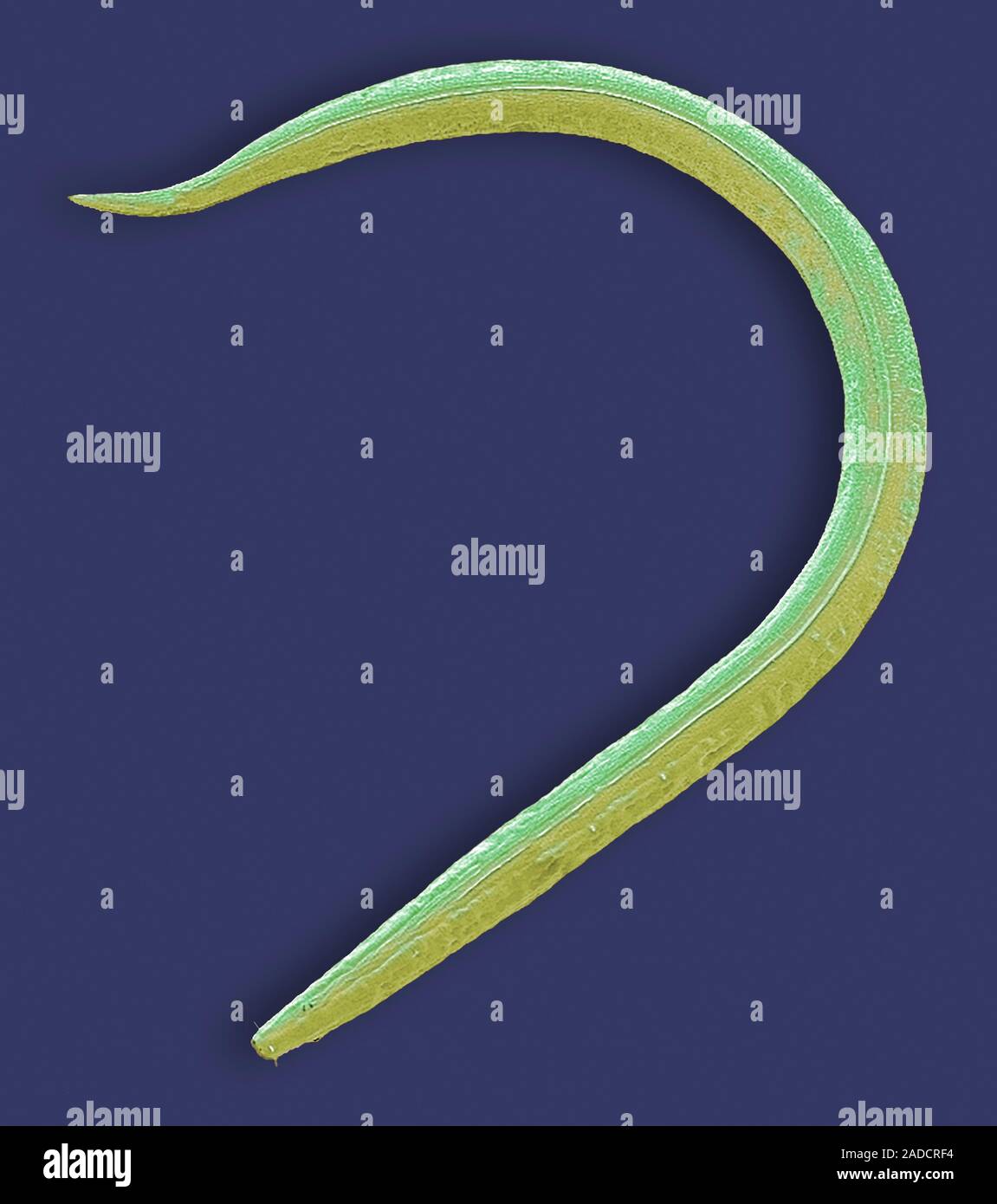 Nematode worm. Coloured scanning electron micrograph (SEM) of a ...