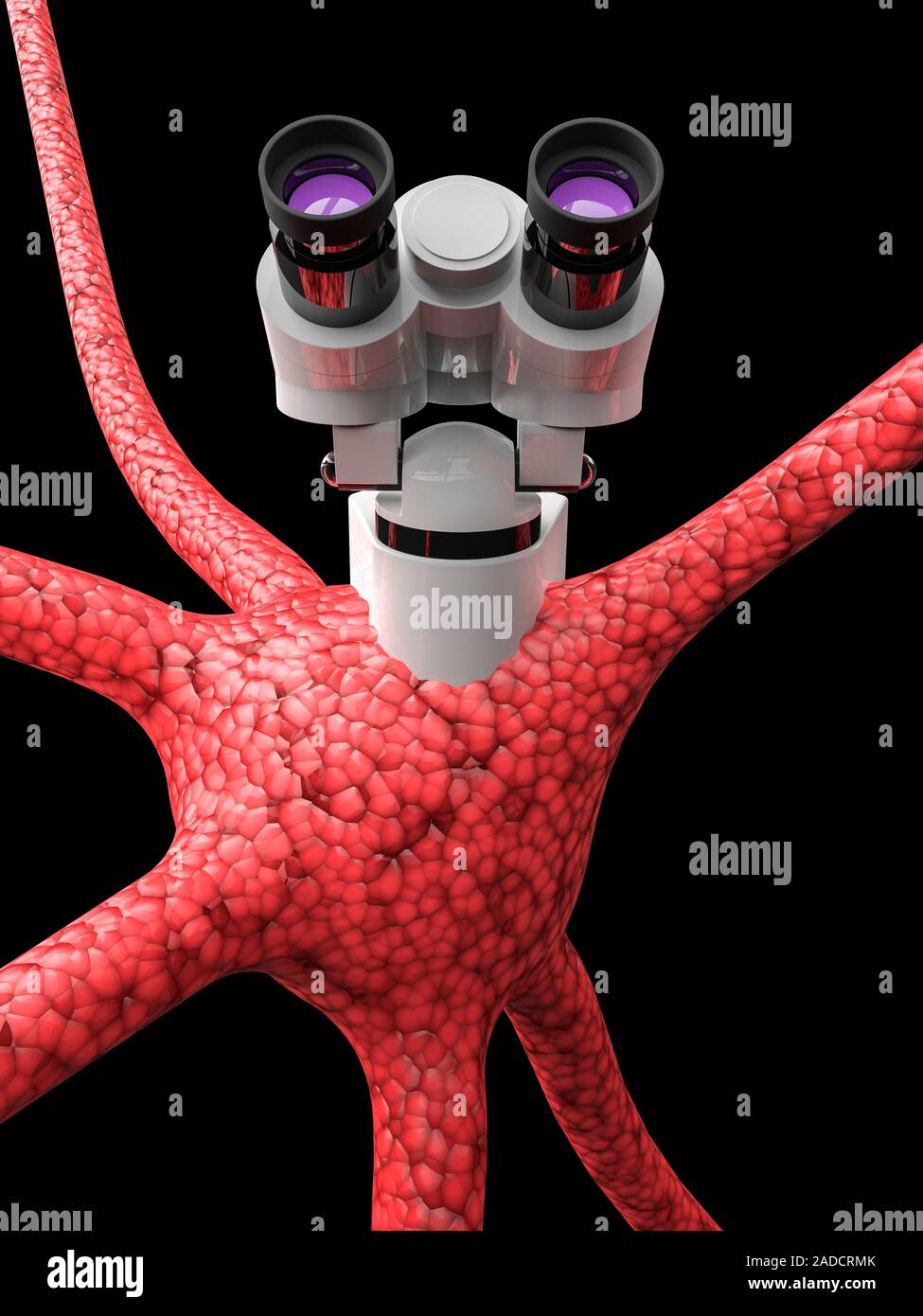 Conceptual computer illustration of a nerve cell being inspected ...