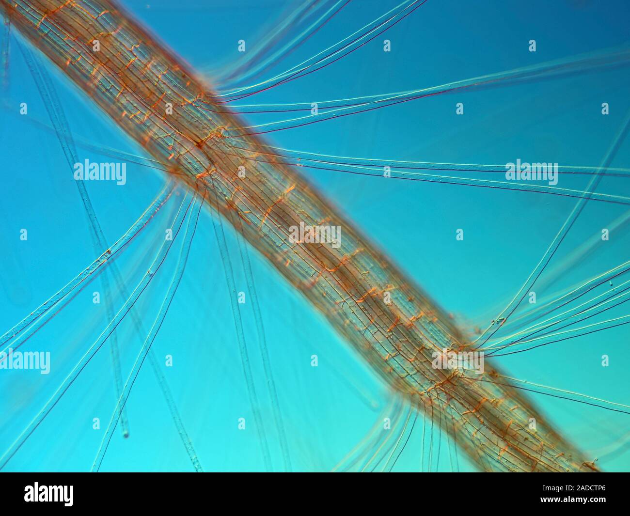 Mosquito fern (Azolla sp.) rootlet, light micrograph. This is an ...