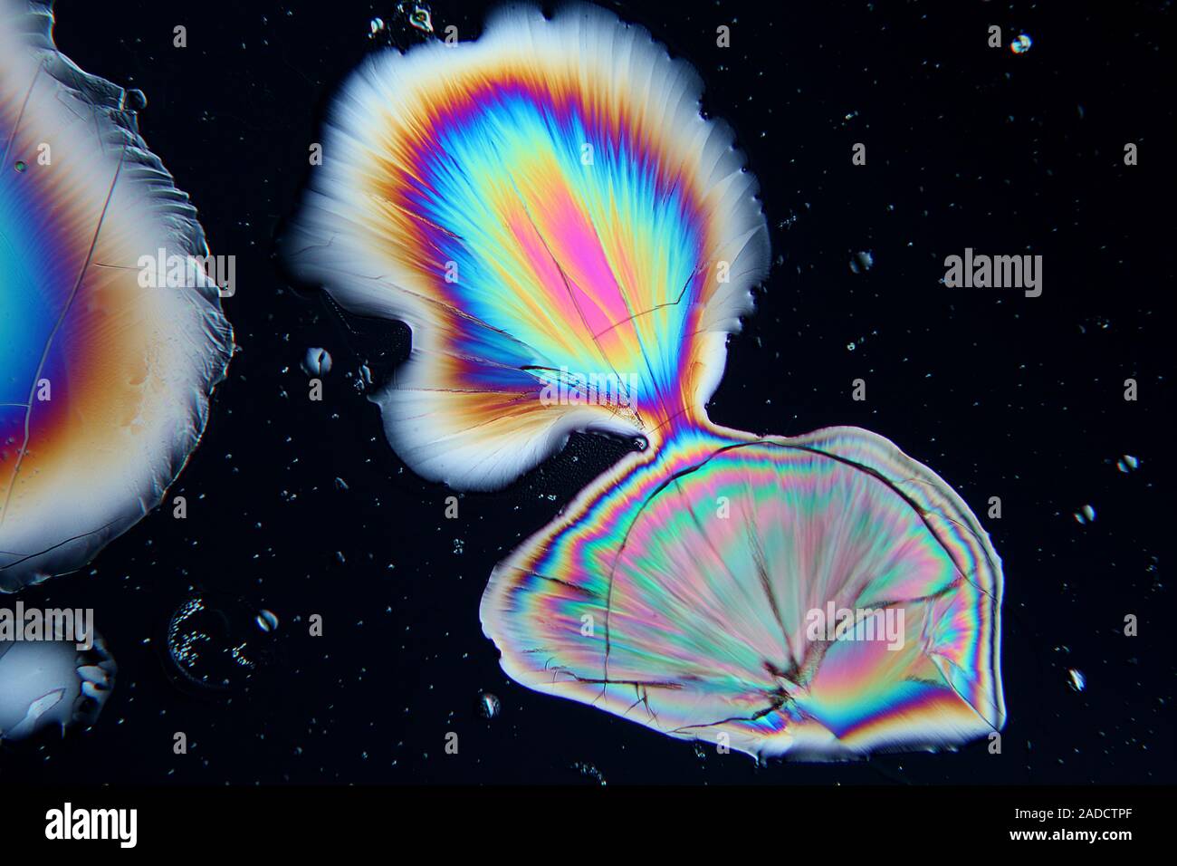 Polarised light micrograph of dopamine (3,4-dihydroxyphenethylamine ...