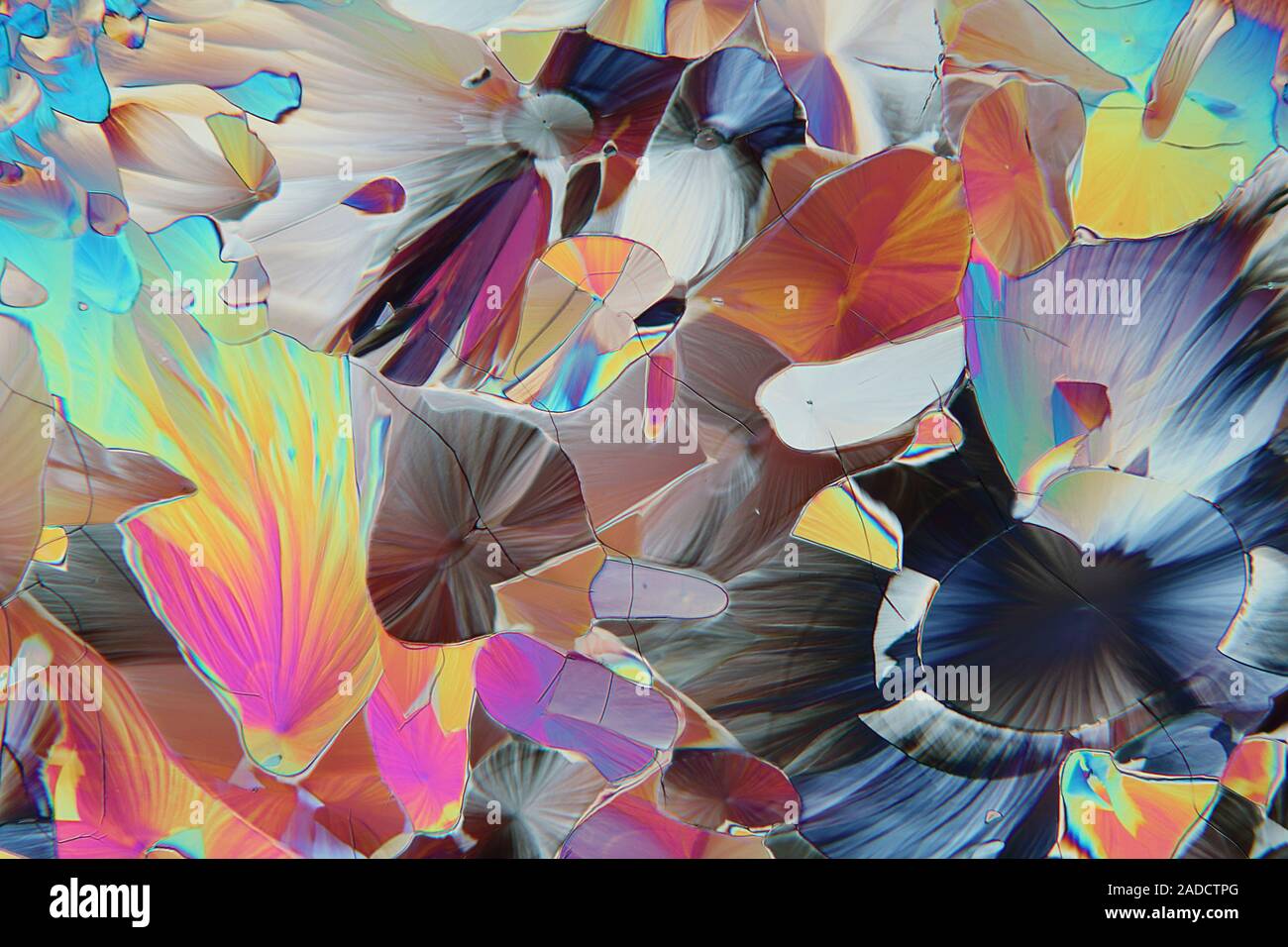 Polarised light micrograph of dopamine (3,4-dihydroxyphenethylamine ...