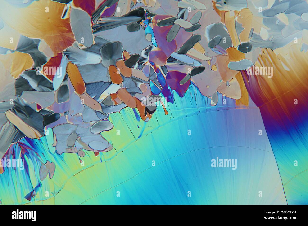 Polarised light micrograph of dopamine (3,4-dihydroxyphenethylamine ...