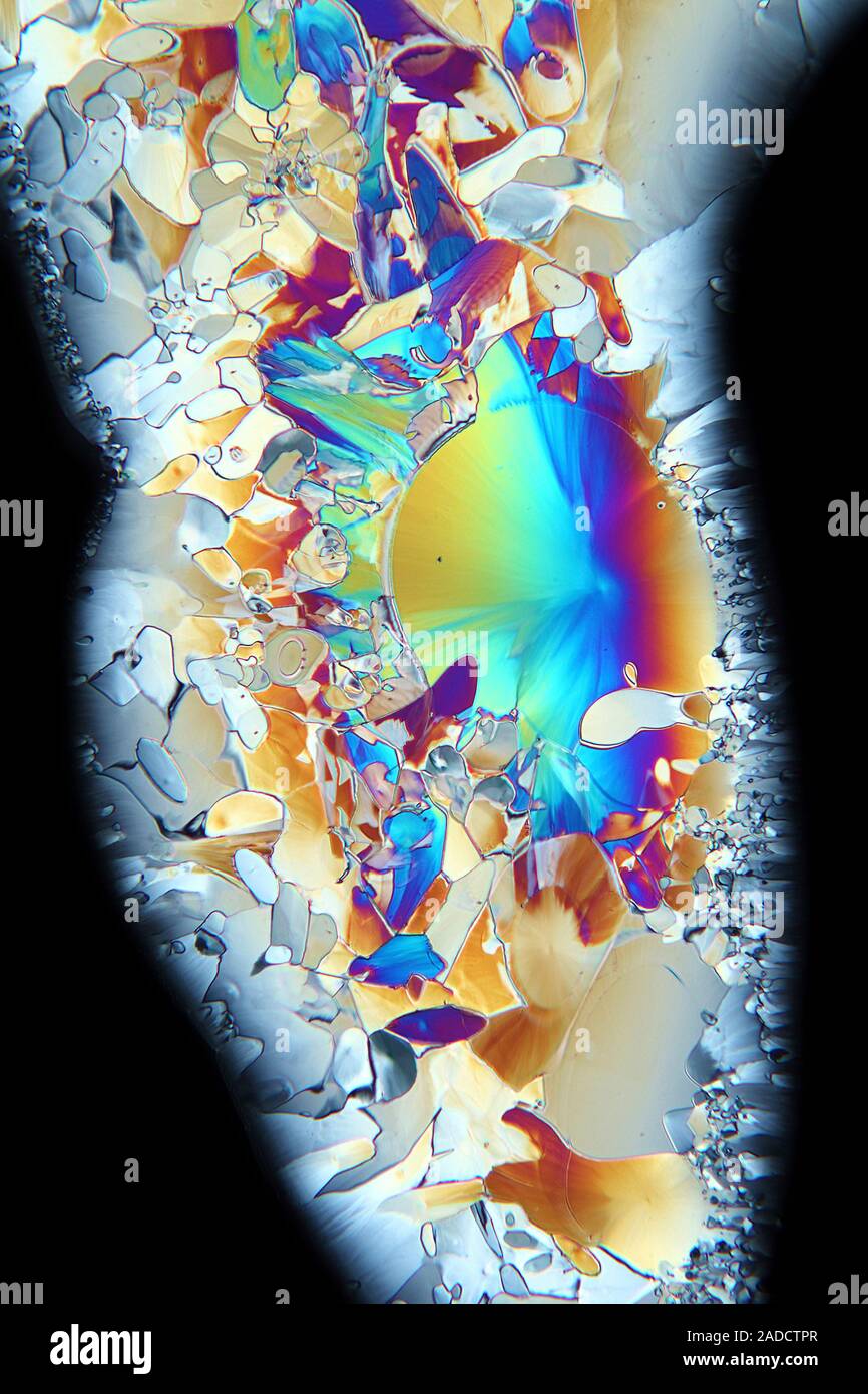 Polarised light micrograph of dopamine (3,4-dihydroxyphenethylamine ...
